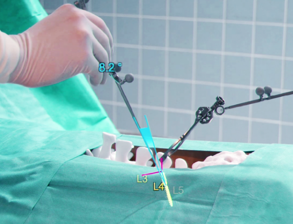 Microsoft HoloLens can improve surgery - BetaNews